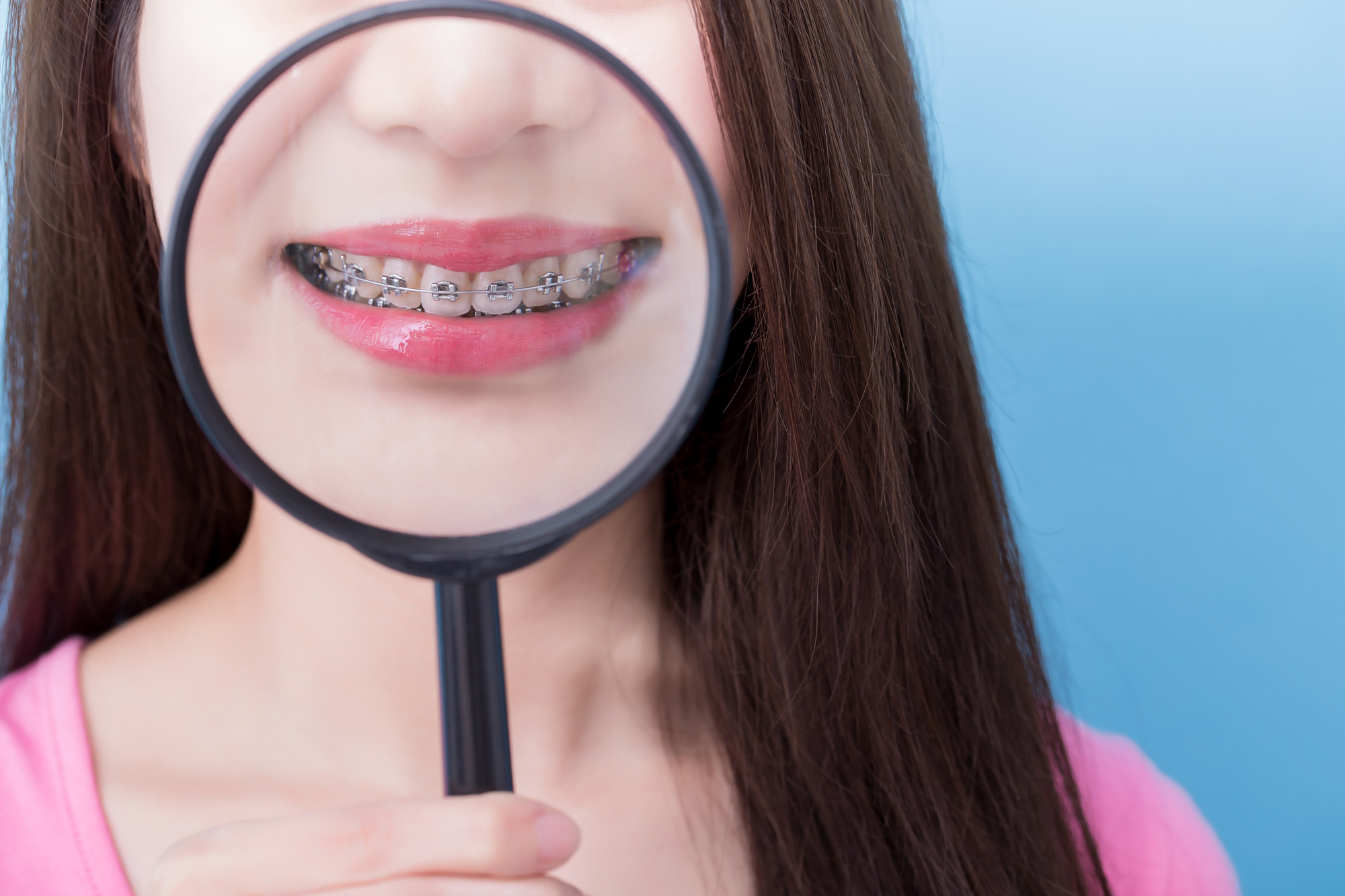 Unraveling the Mystery: How are braces made? - Harmony Orthodontics